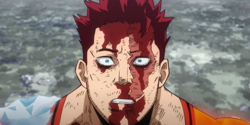 My Hero Academia: Dabi's True Identity, CONFIRMED!