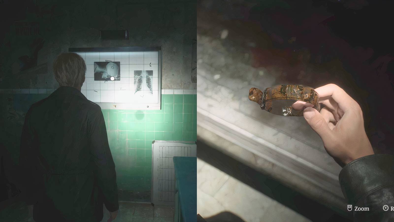 X-Ray Viewer Puzzle Solution In Silent Hill 2 Remake